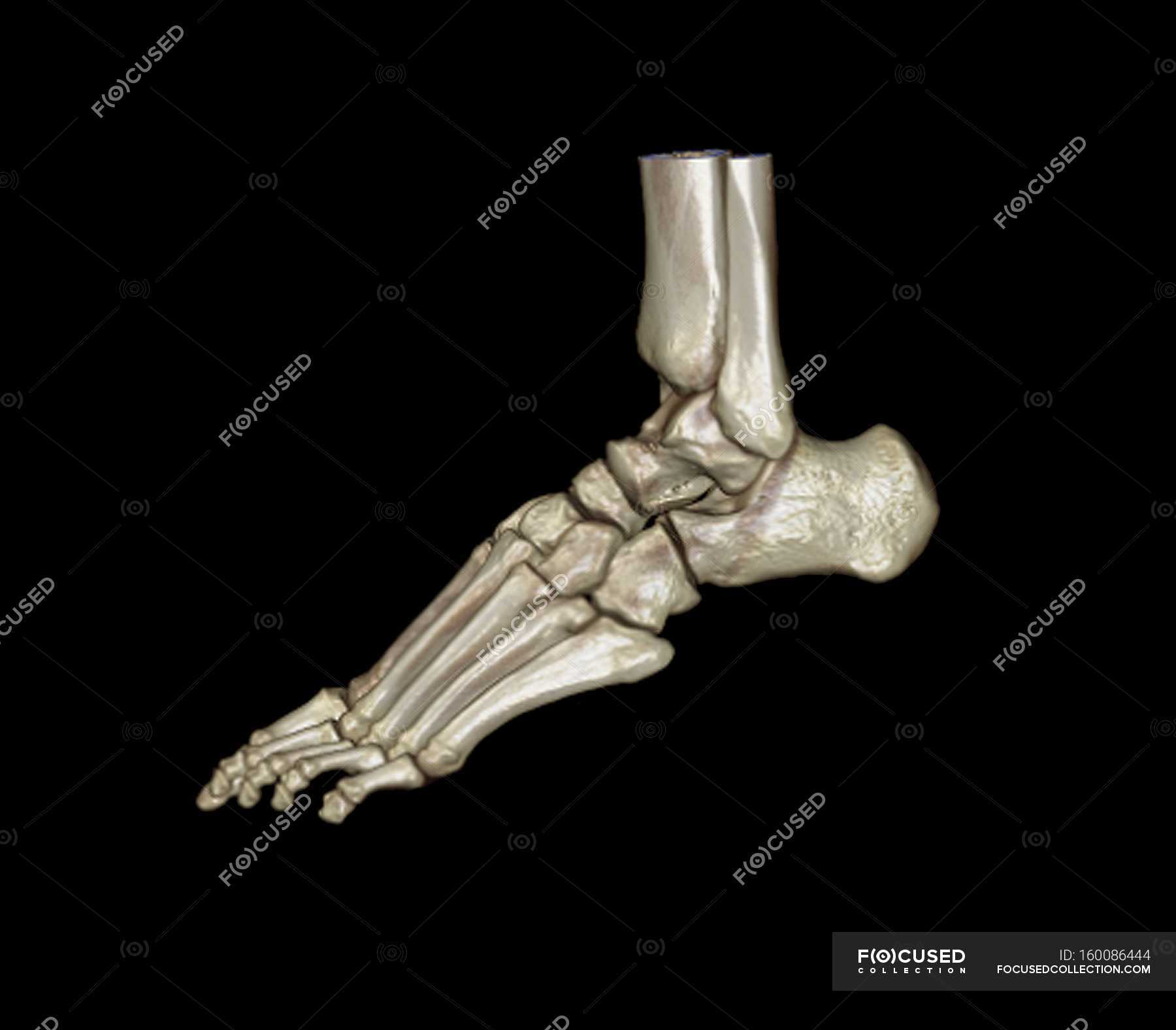 Coloured 3D computed tomography (CT) scan of the healthy foot of a 23 ... Coloured 3D computed tomography (CT) scan of the healthy foot of a 23 ...