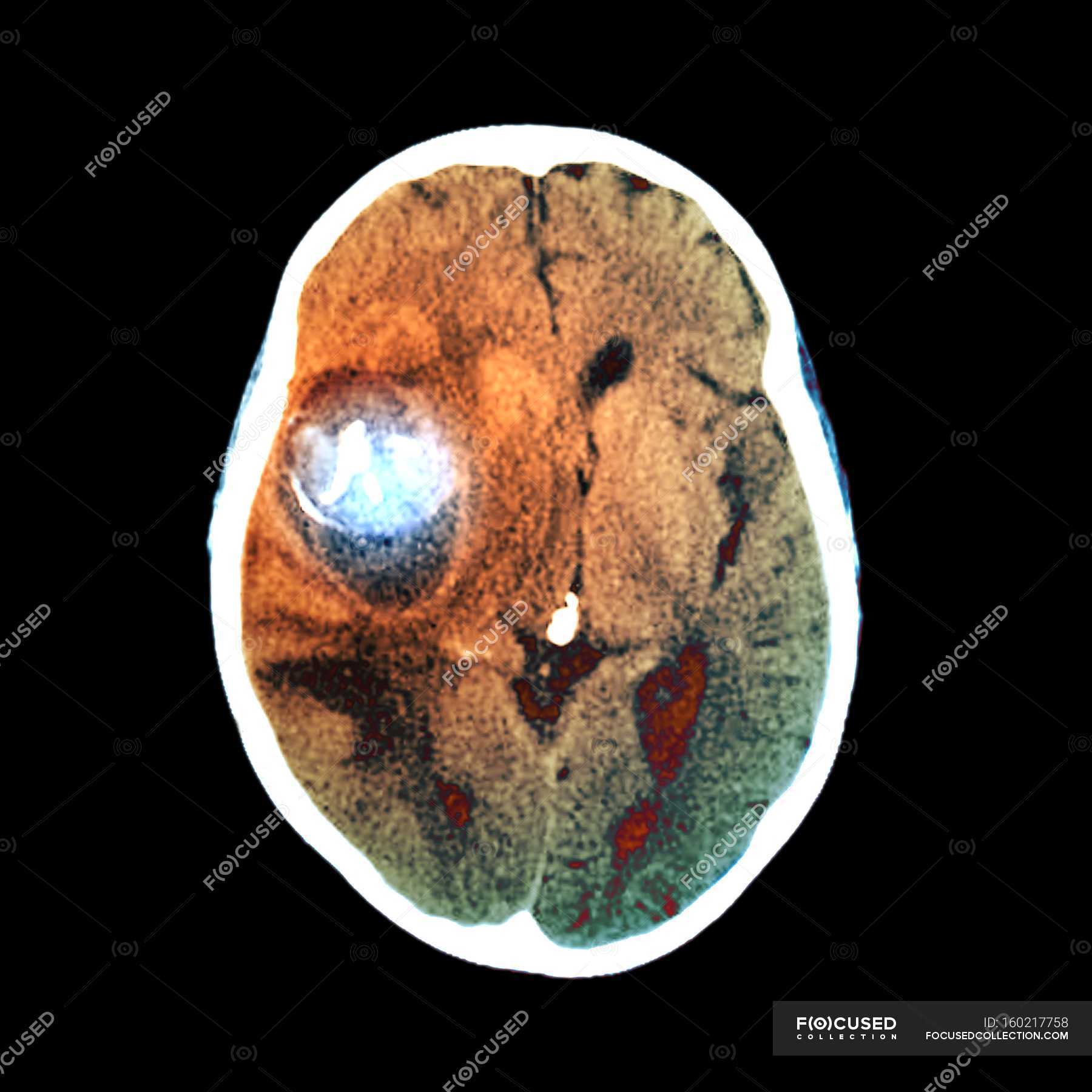 Computed tomography scan - Stock Photos, Royalty Free Images | Focused Computed tomography scan - Stock Photos, Royalty Free Images | Focused