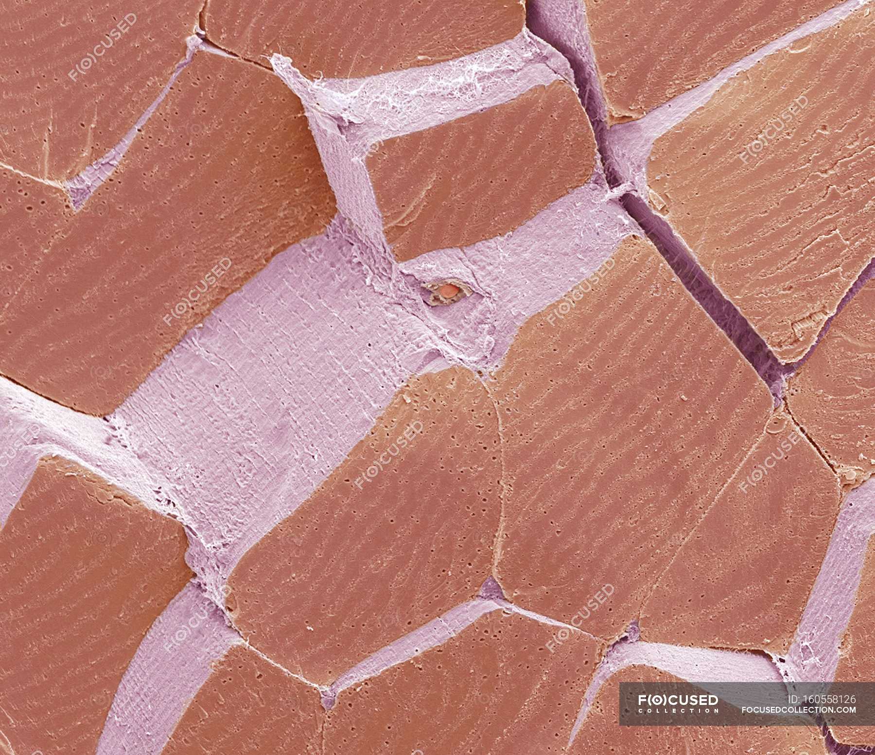 Coloured Scanning Electron Micrograph Sem Of A Section Through