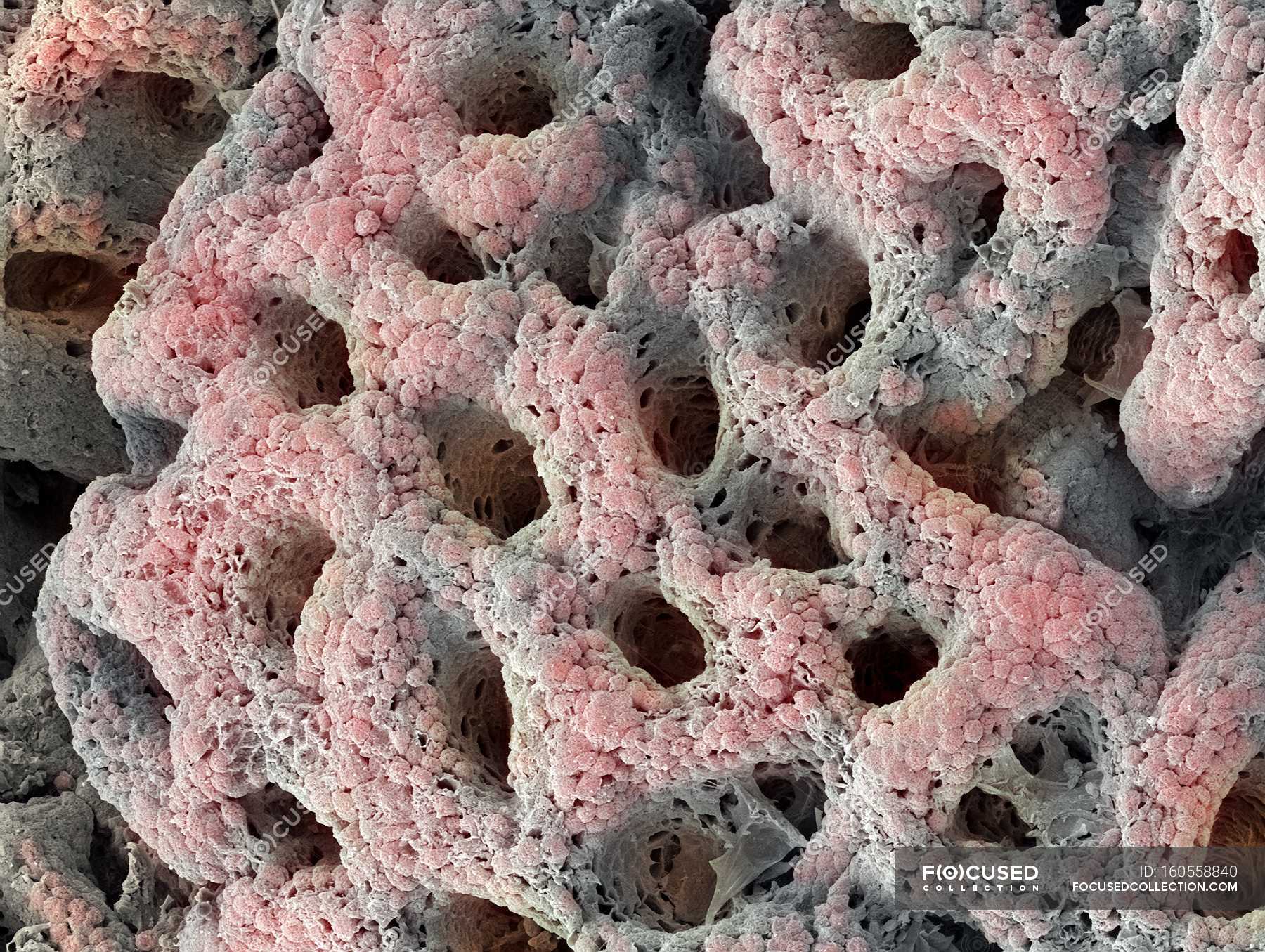 Coloured scanning electron micrograph (SEM) of the inner lining of the ...