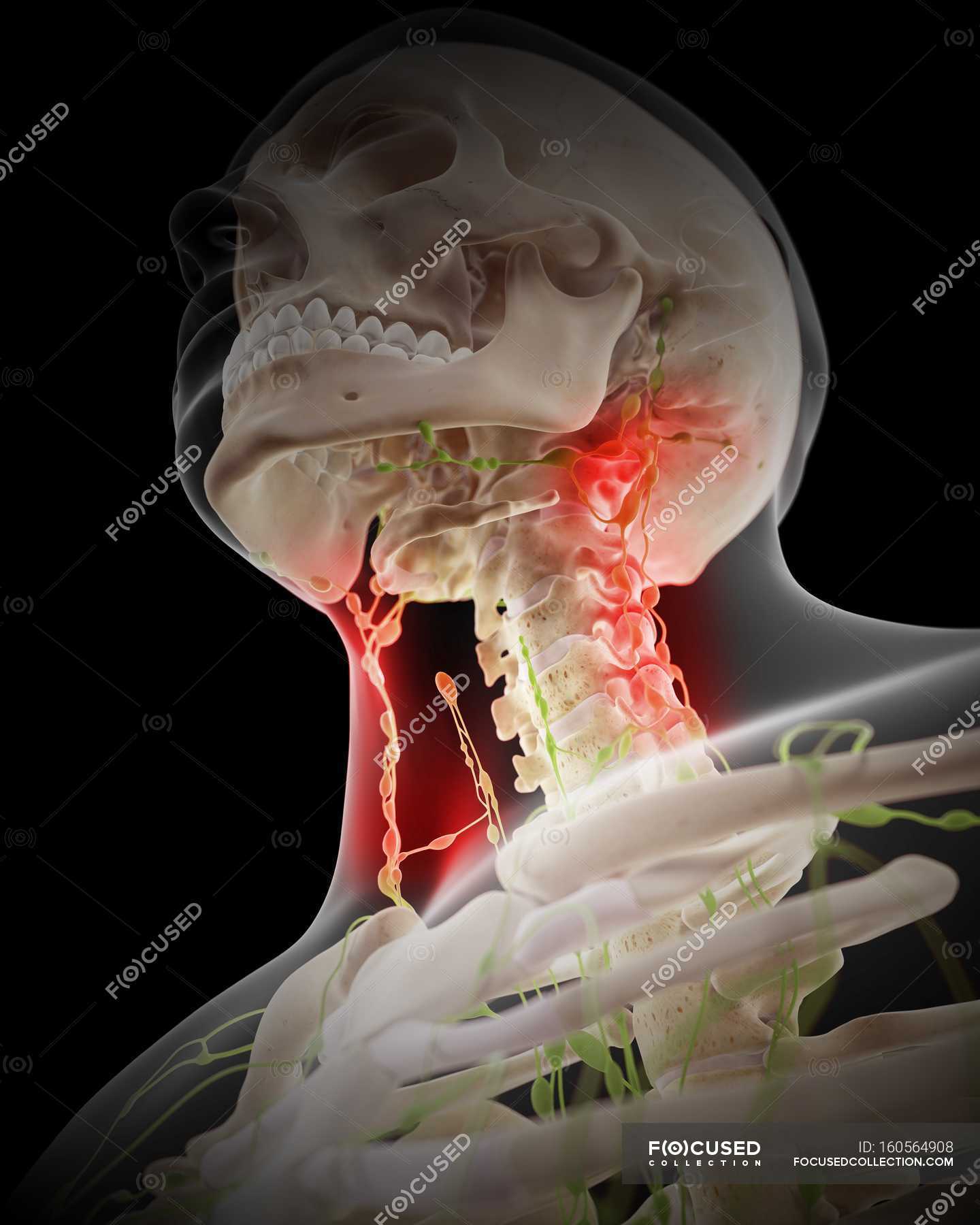 Painful human lymph nodes — skull, neck - Stock Photo | #160564908 Painful human lymph nodes — skull, neck - Stock Photo | #160564908