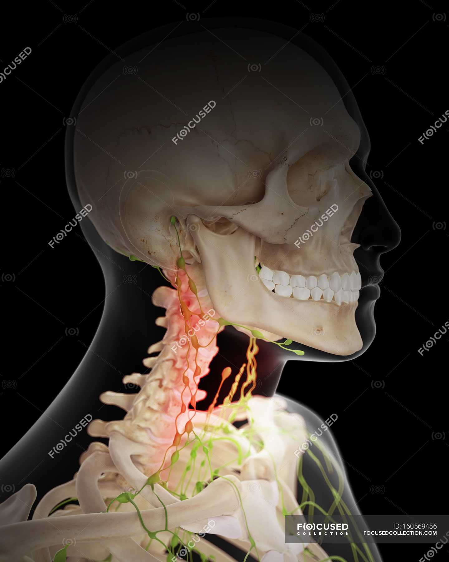 Painful human lymph nodes — conceptual, unhealthy - Stock Photo ... Painful human lymph nodes — conceptual, unhealthy - Stock Photo ...