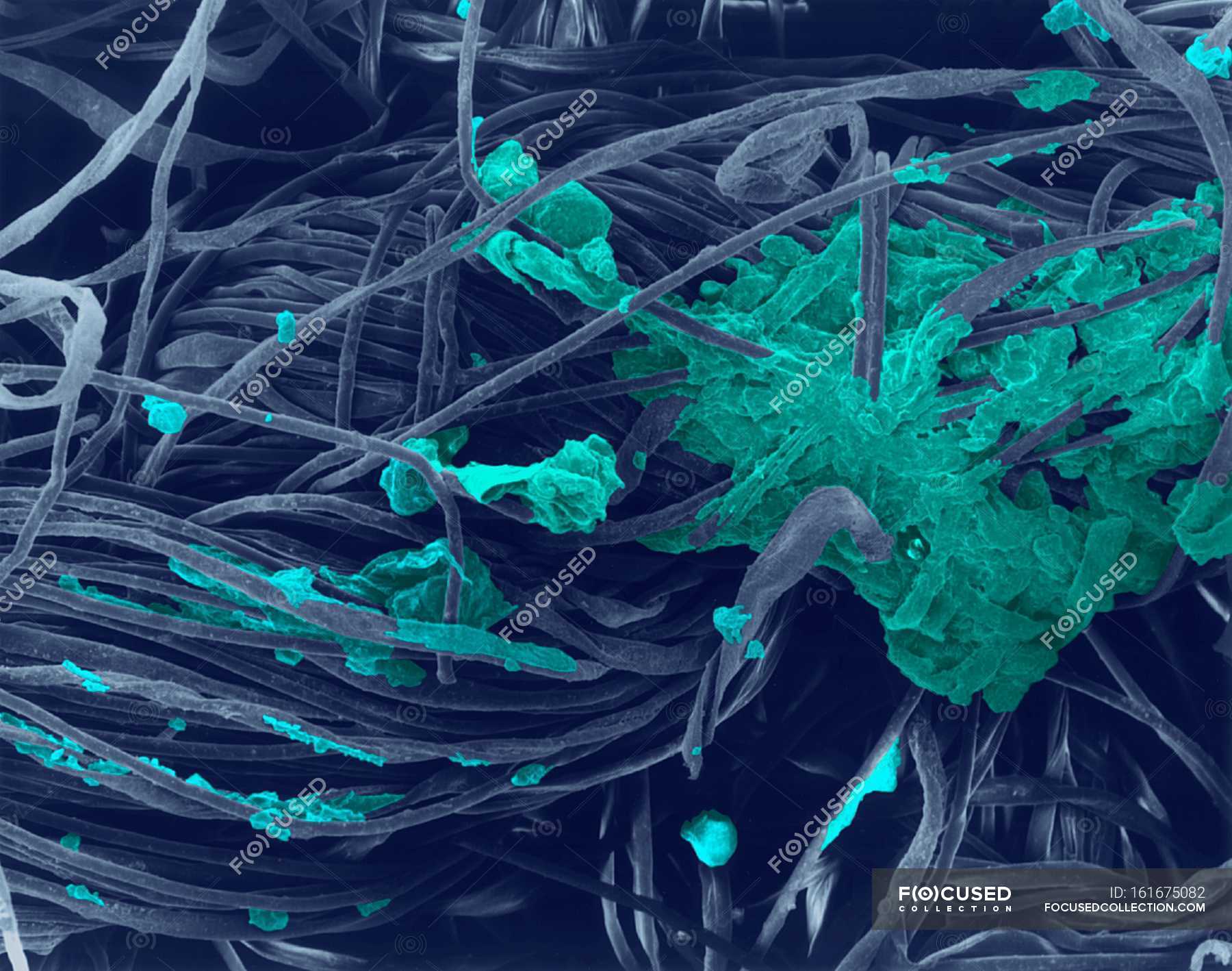 Coloured Scanning Electron Micrograph Sem Of Cotton T Shirt Collar