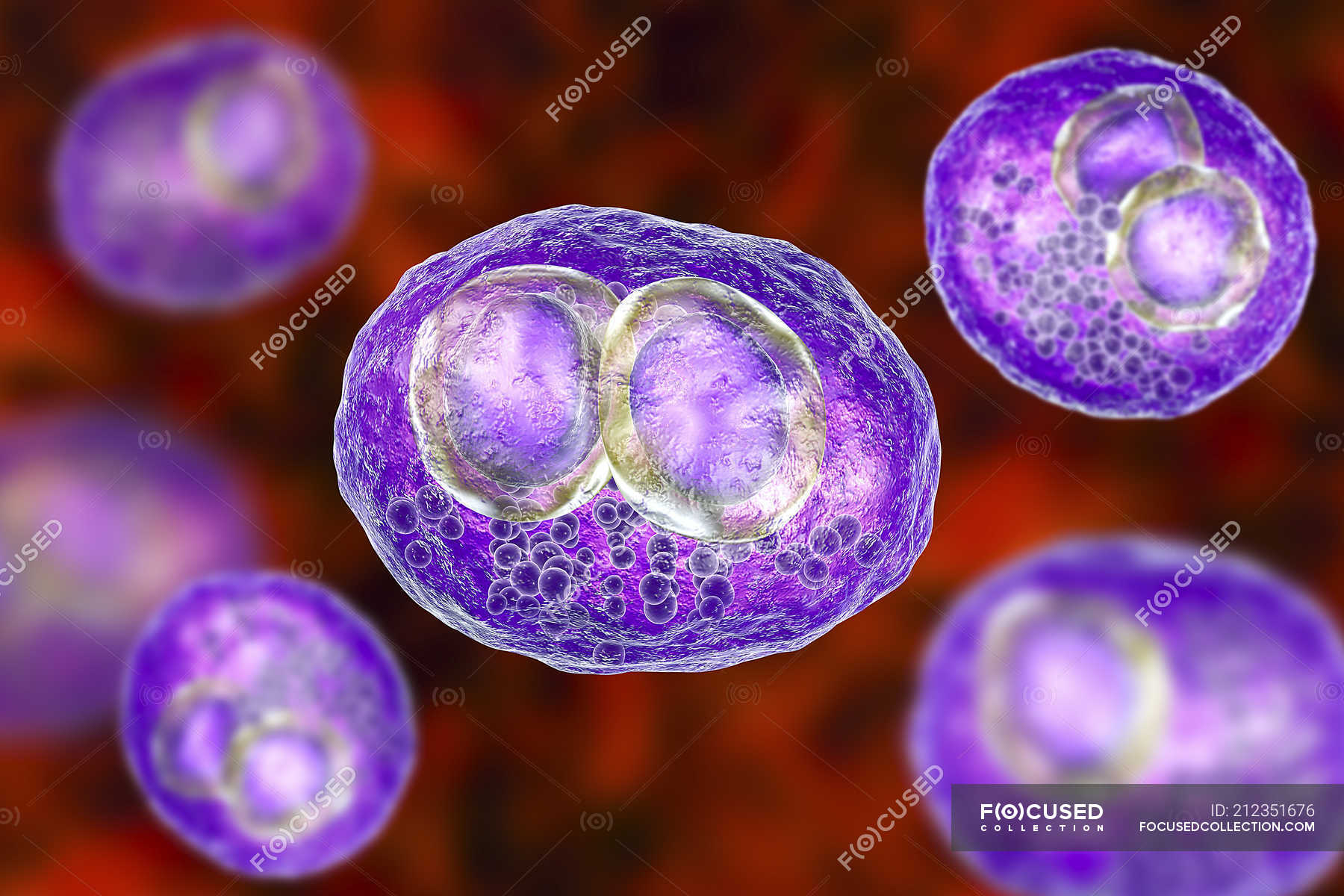 Digital Artwork Of Human Cells With Cytomegalic Inclusion Disease digital-artwork-of-human-cells-with-cytomegalic-inclusion-disease