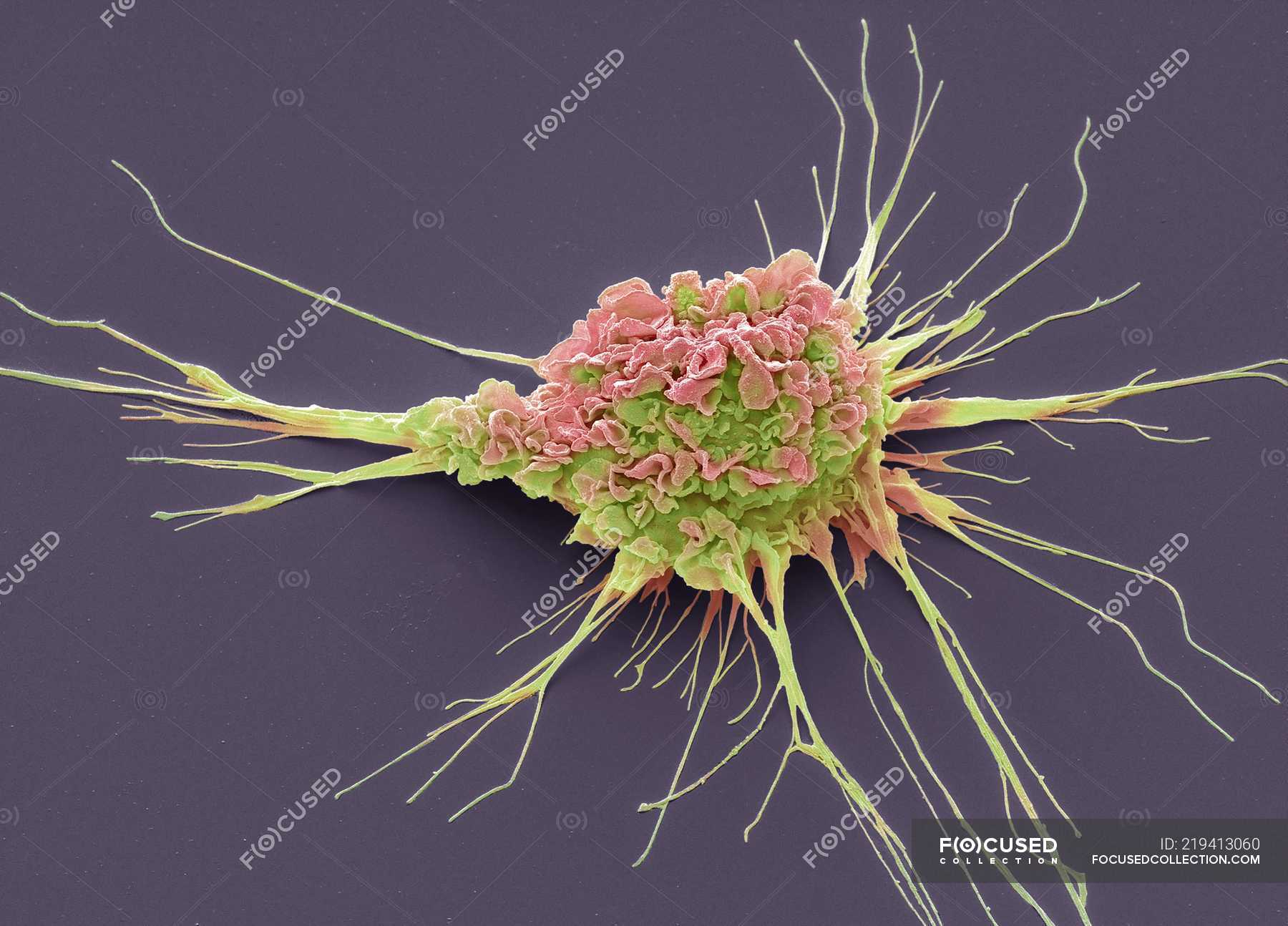 Colored scanning electron micrograph of protective dendritic cell of ... Colored scanning electron micrograph of protective dendritic cell of ...