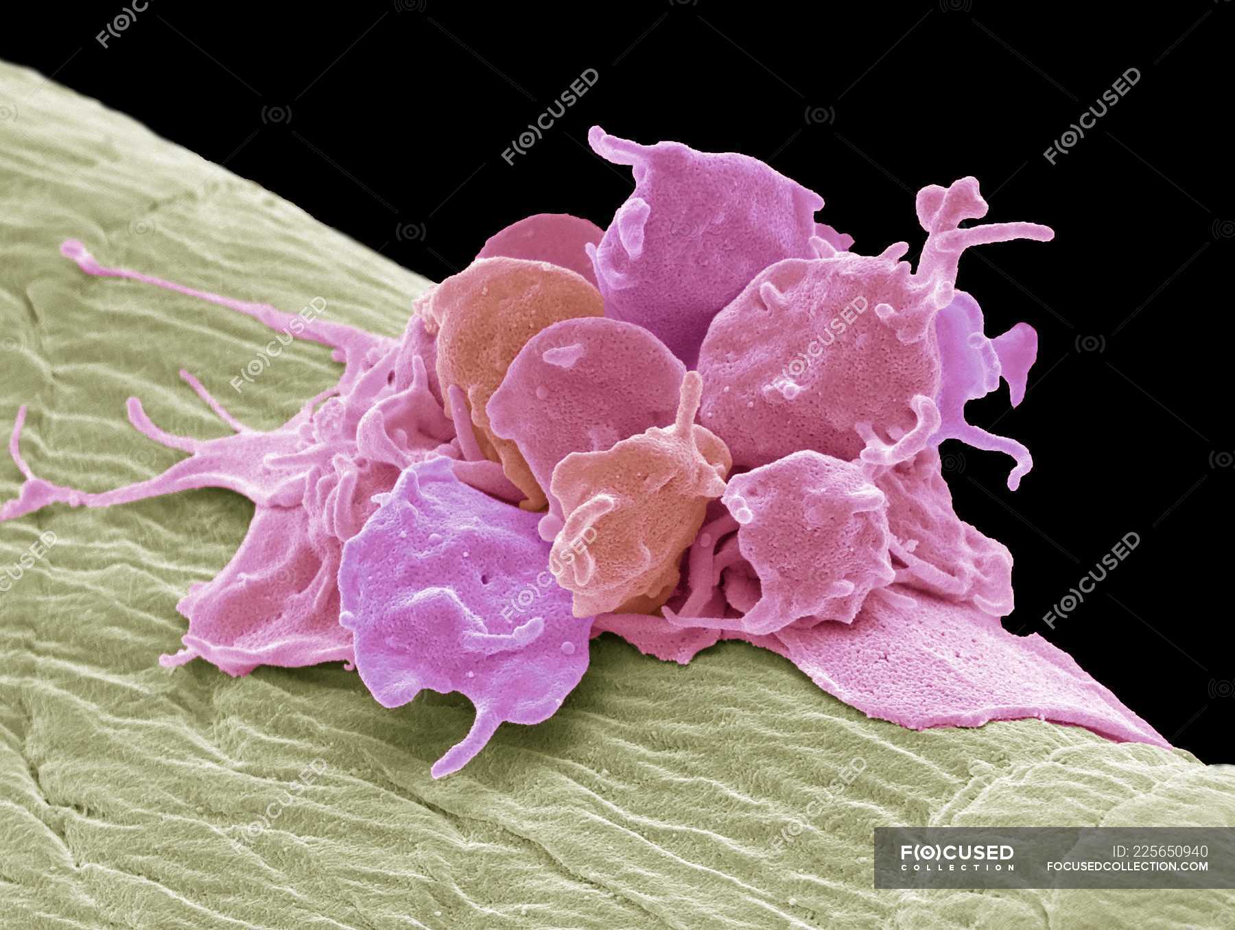 Coloured scanning electron micrograph of activated platelets attached ... Coloured scanning electron micrograph of activated platelets attached ...