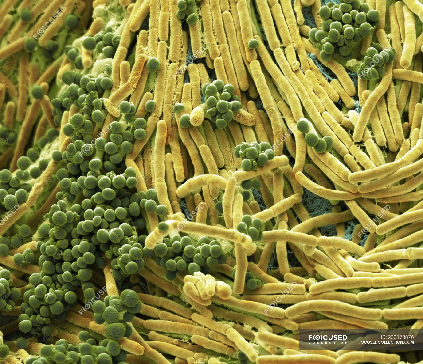 Coloured scanning electron micrograph of bacteria cultured from mobile ... Coloured scanning electron micrograph of bacteria cultured from mobile ...