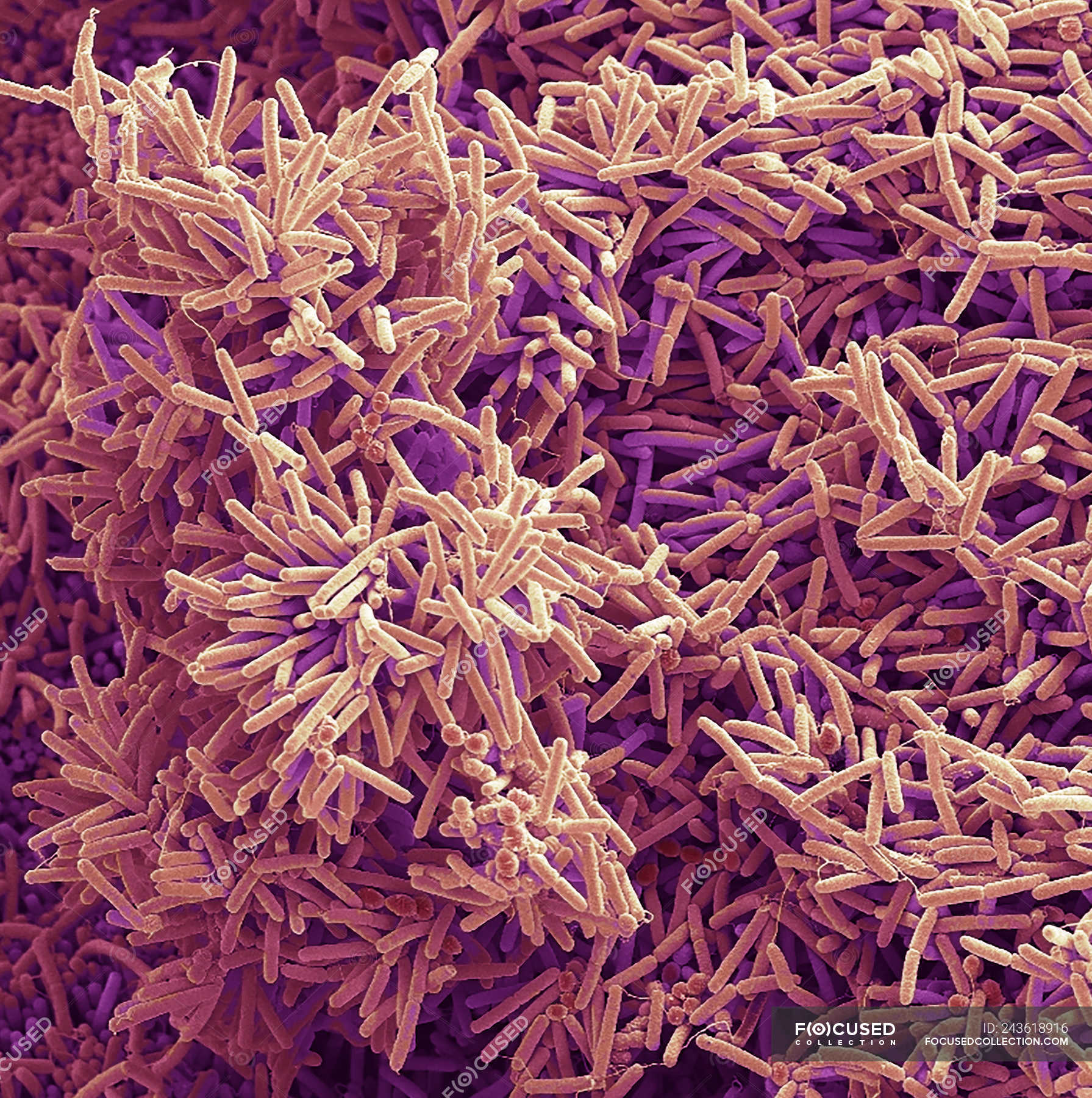 Plaque-forming bacteria, colored scanning electron micrograph ... Plaque-forming bacteria, colored scanning electron micrograph ...