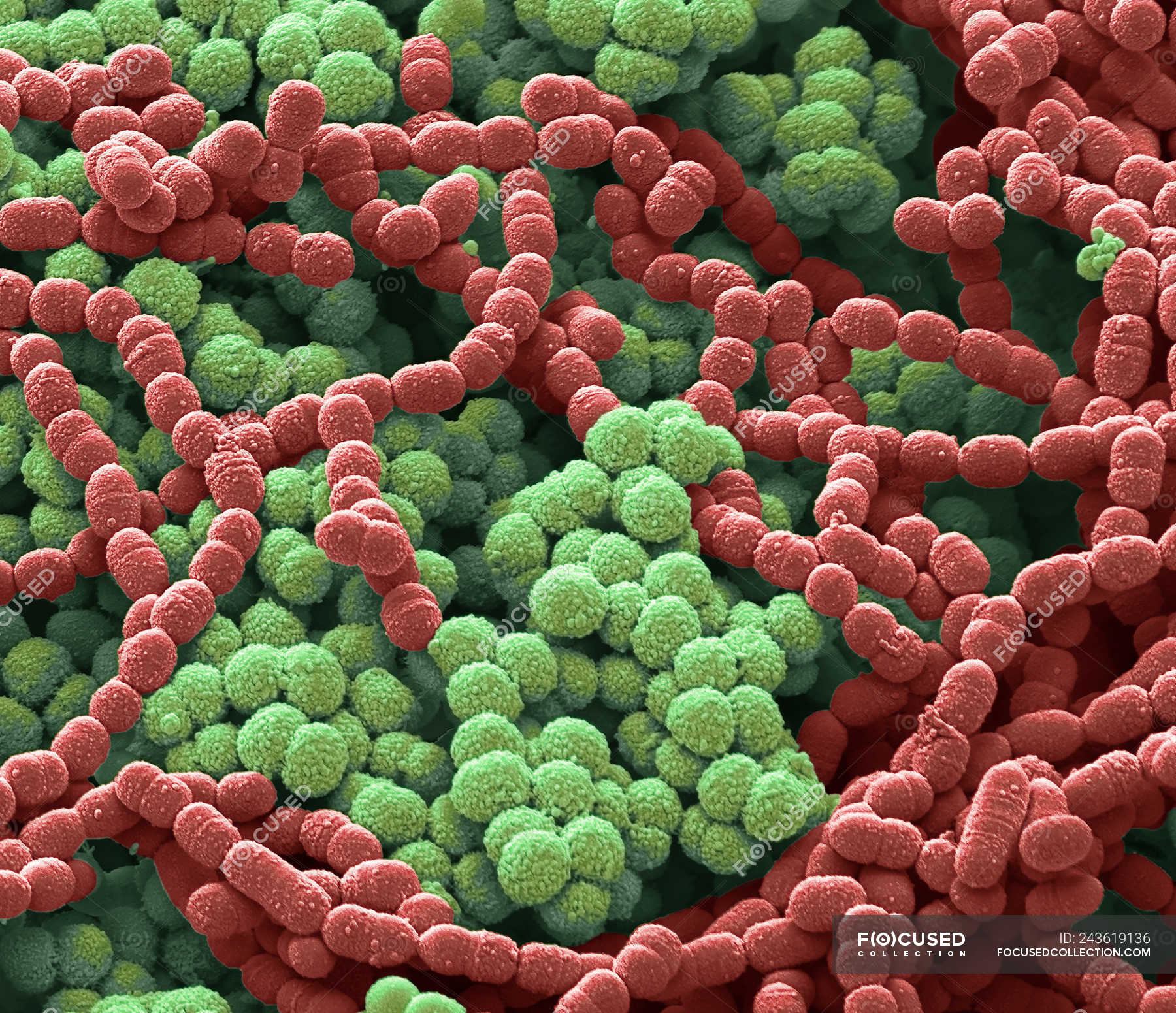 Scanning electron micrograph of bacterial culture from sputum ... Scanning electron micrograph of bacterial culture from sputum ...