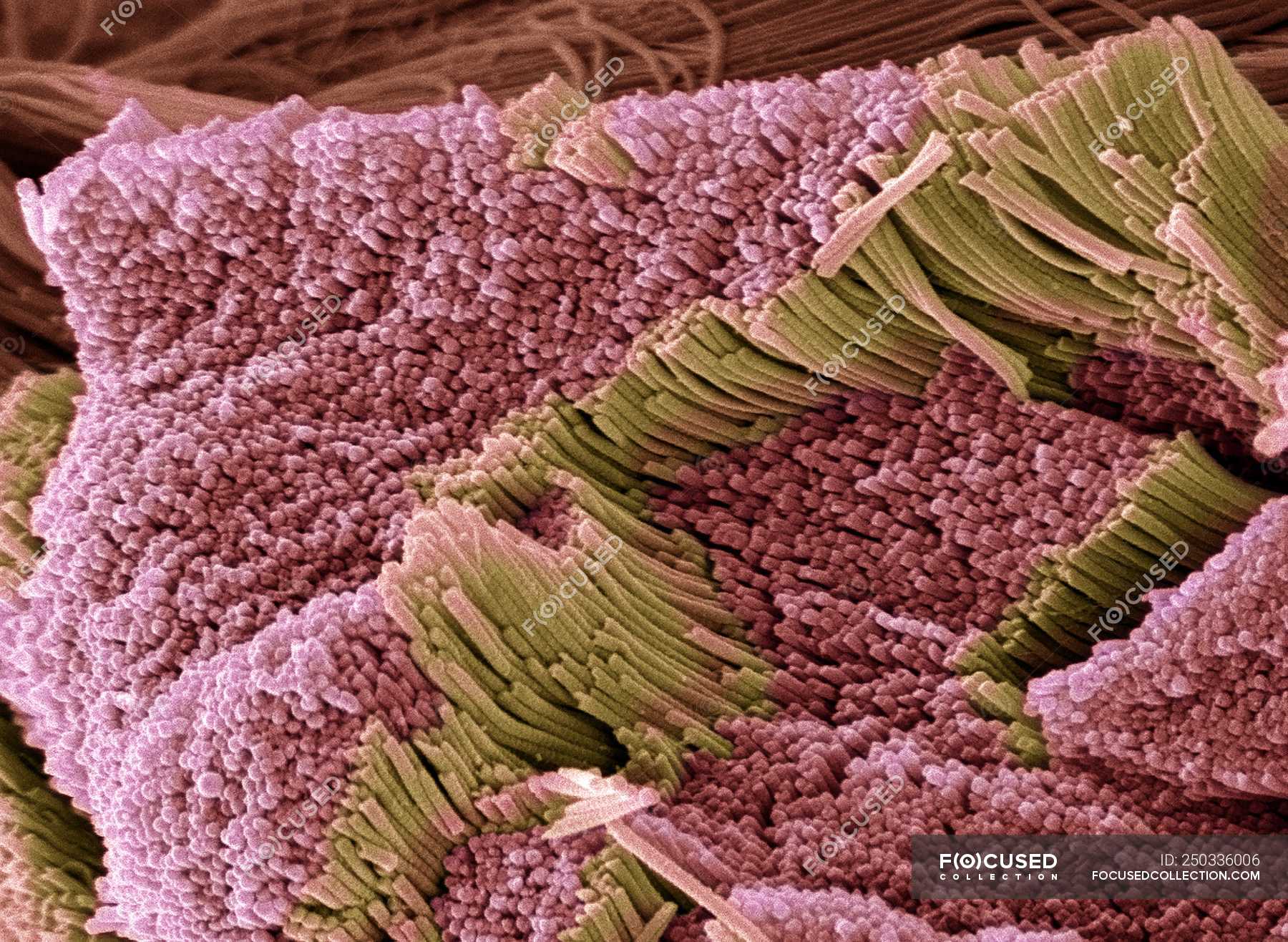 Tendon, coloured scanning electron micrograph showing bundles of ... Tendon, coloured scanning electron micrograph showing bundles of ...