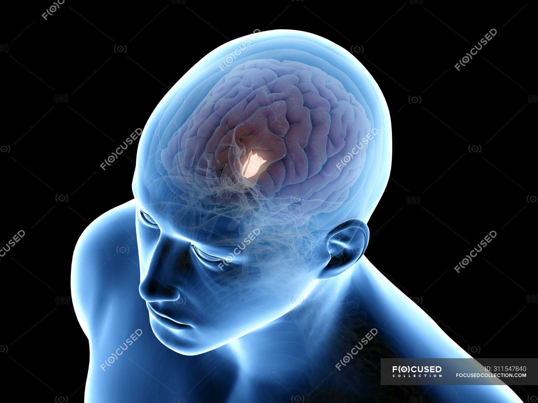 Human body with detailed hypothalamus in brain, computer illustration. — 3d rendering, medical ...