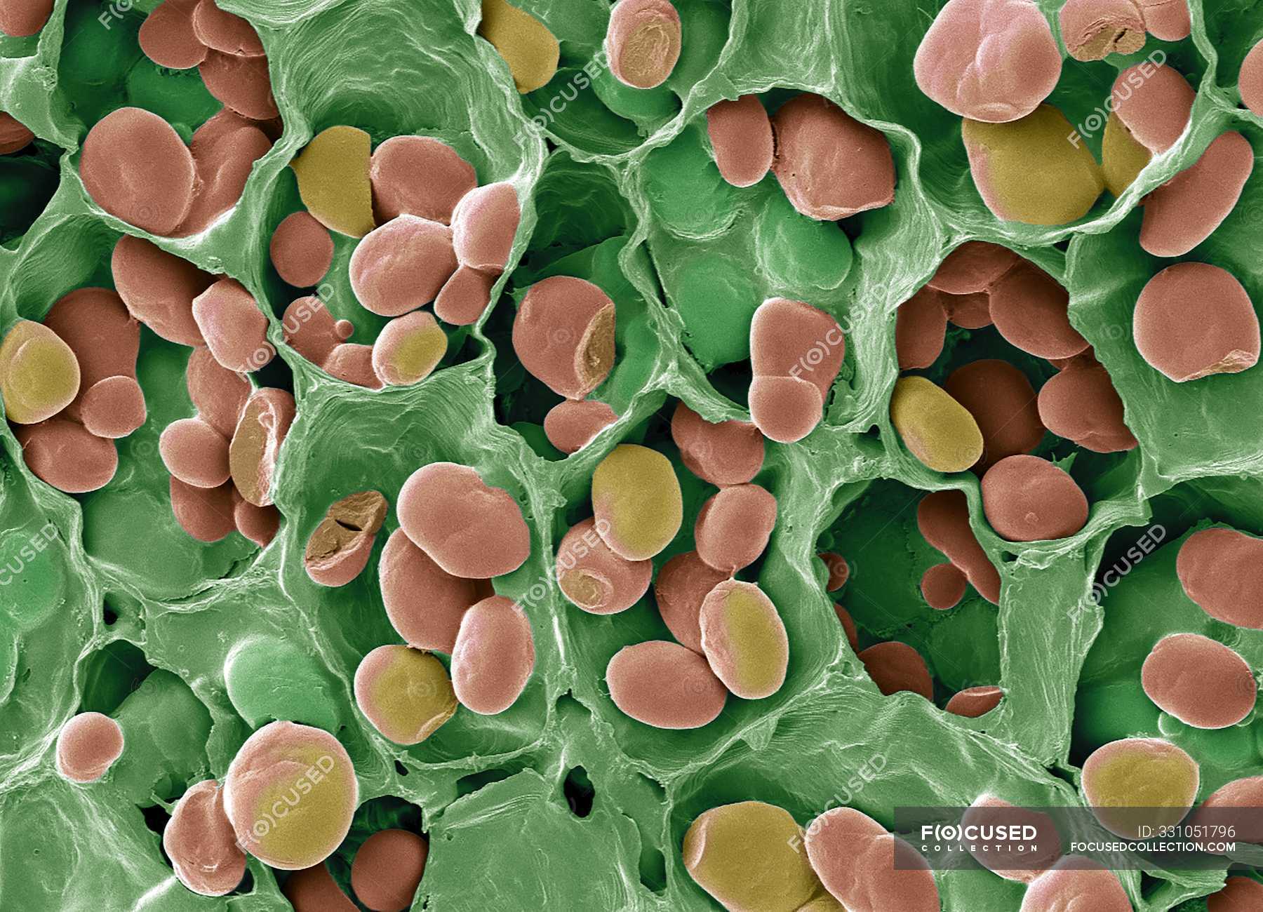 Colored scanning electron micrograph of starch grains in seed of legume ... Colored scanning electron micrograph of starch grains in seed of legume ...