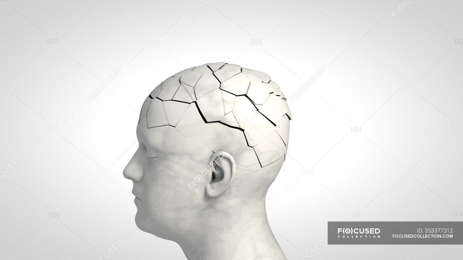 Dementia, conceptual computer illustration — 3d, loss - Stock Photo ... Dementia, conceptual computer illustration — 3d, loss - Stock Photo ...