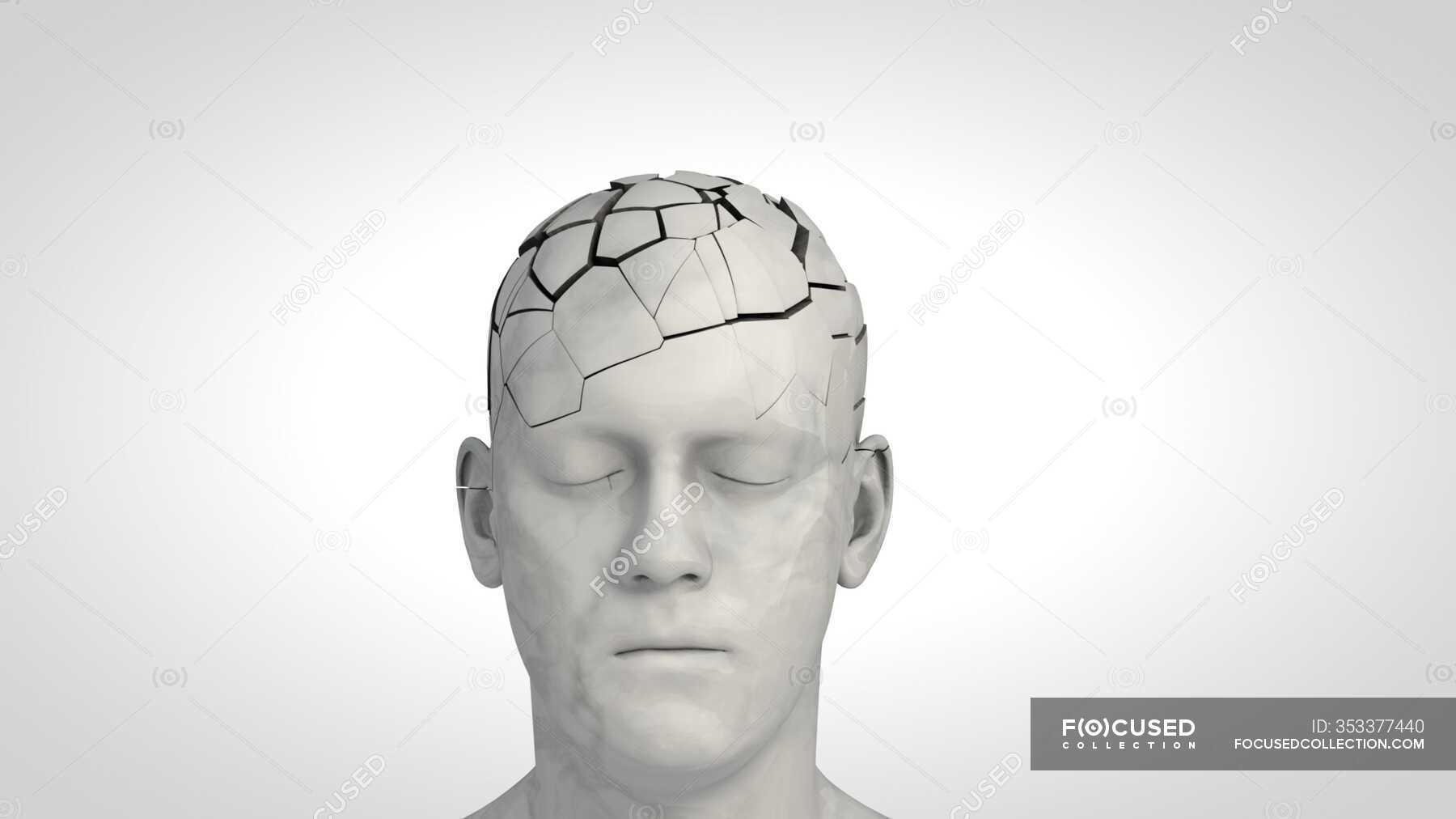 Dementia, conceptual computer illustration — health, head - Stock Photo ... Dementia, conceptual computer illustration — health, head - Stock Photo ...