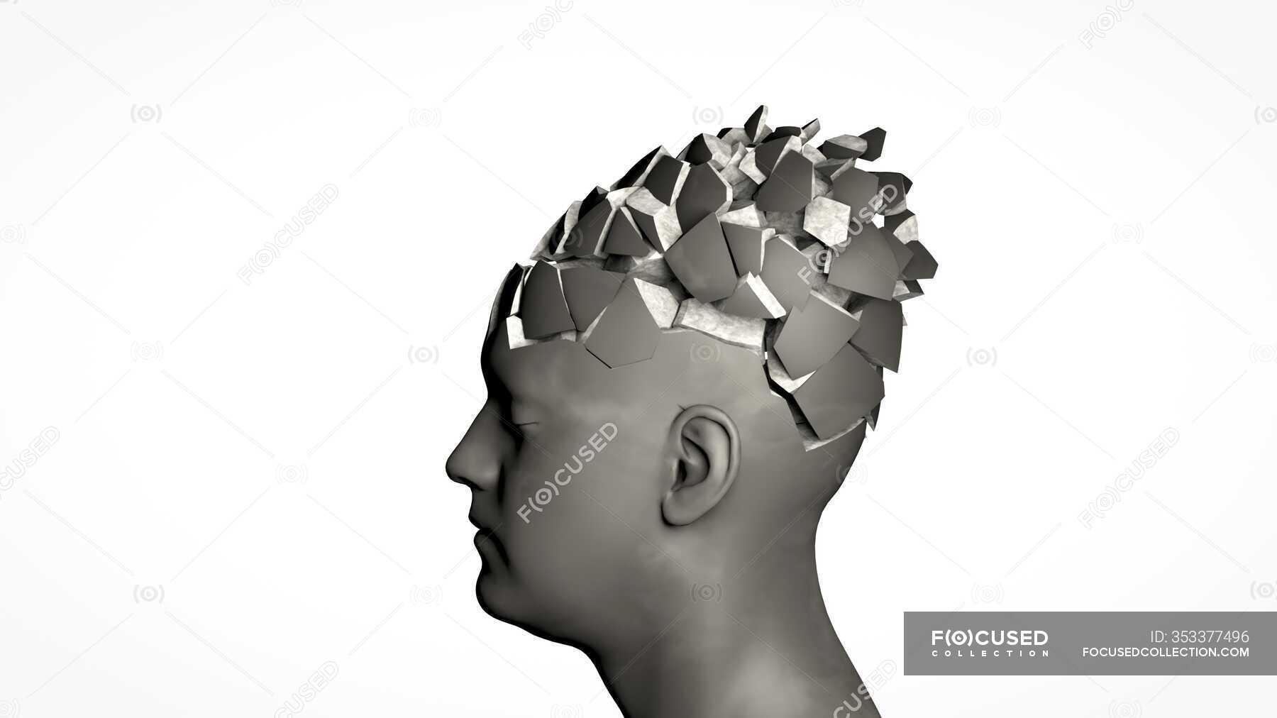 Dementia, conceptual computer illustration — medicine, loss - Stock ... Dementia, conceptual computer illustration — medicine, loss - Stock ...