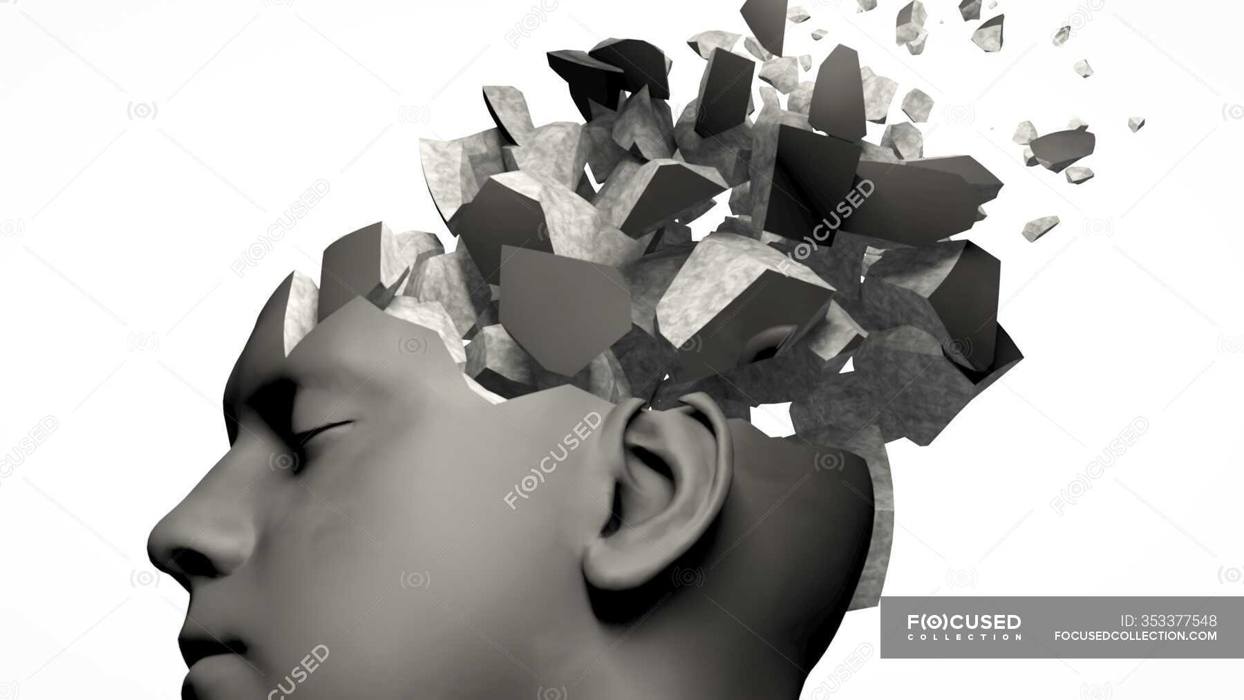 Dementia, conceptual computer illustration — alzheimers, Cracking ... Dementia, conceptual computer illustration — alzheimers, Cracking ...