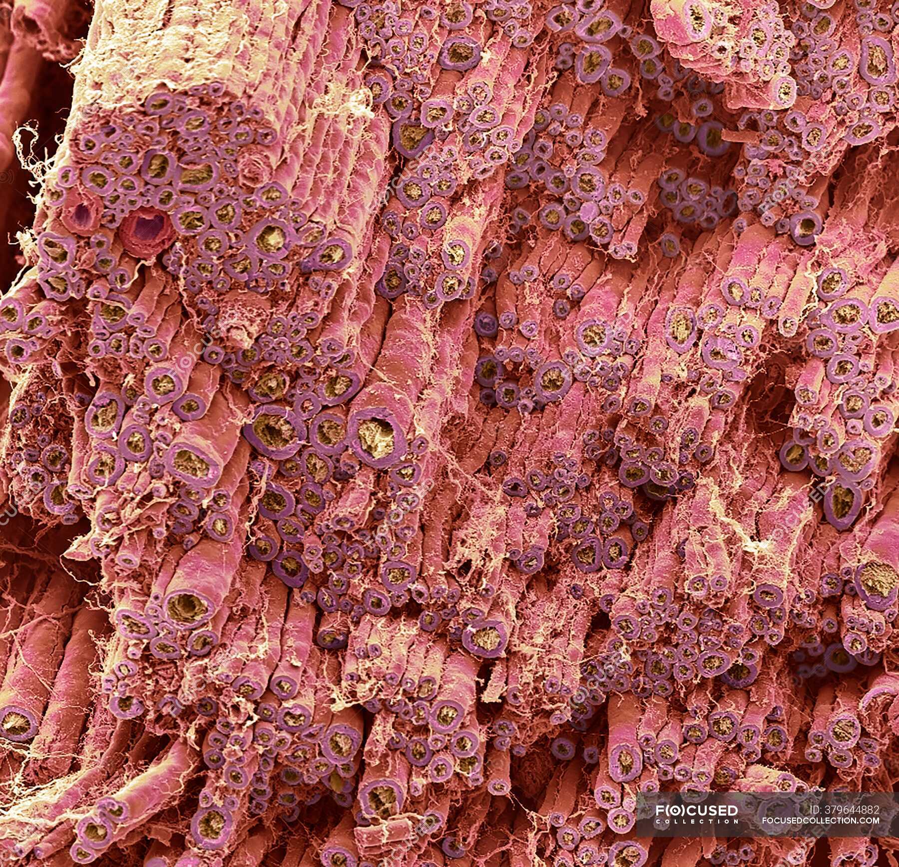 Nerve. Coloured scanning electron micrograph (SEM) of a freeze-fracture ... Nerve. Coloured scanning electron micrograph (SEM) of a freeze-fracture ...