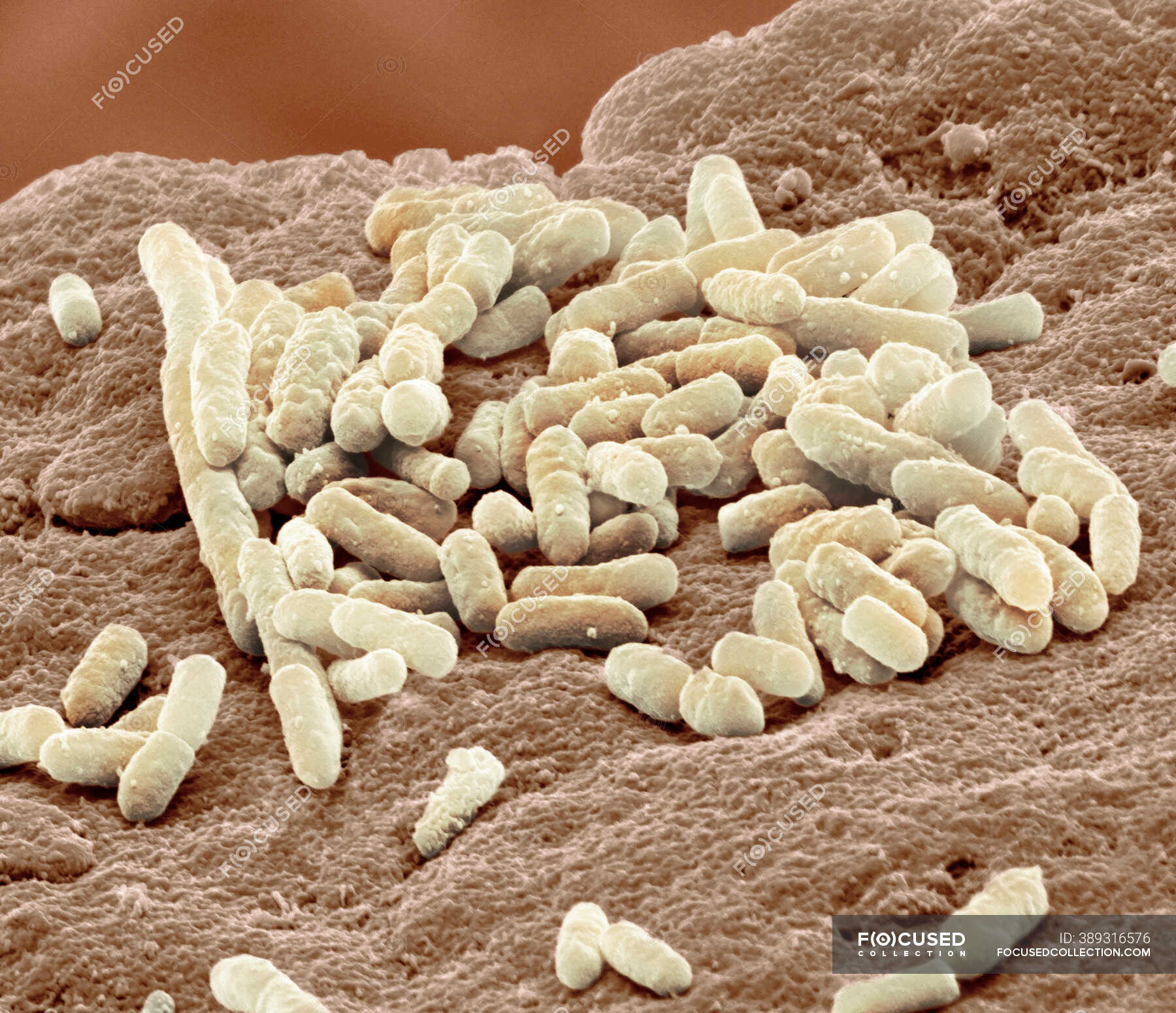 Micrografía electrónica de barrido coloreada de la bacteria Gram-negativa Escherichia coli, en ...