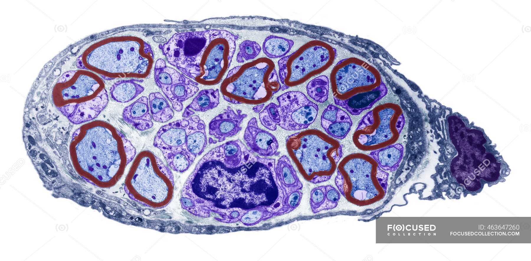 Peripheral Nerve Coloured Transmission Electron Micrograph Tem Of A Section Through A Small