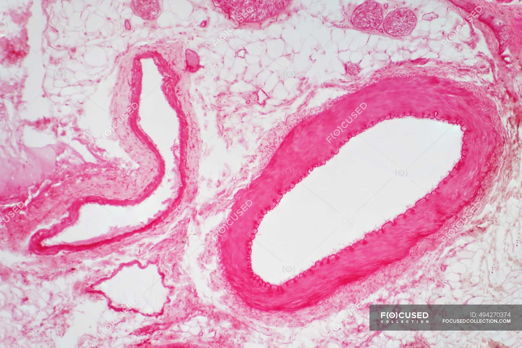 Light Micrograph Of An Artery Vascular Cross Section — Macro No One