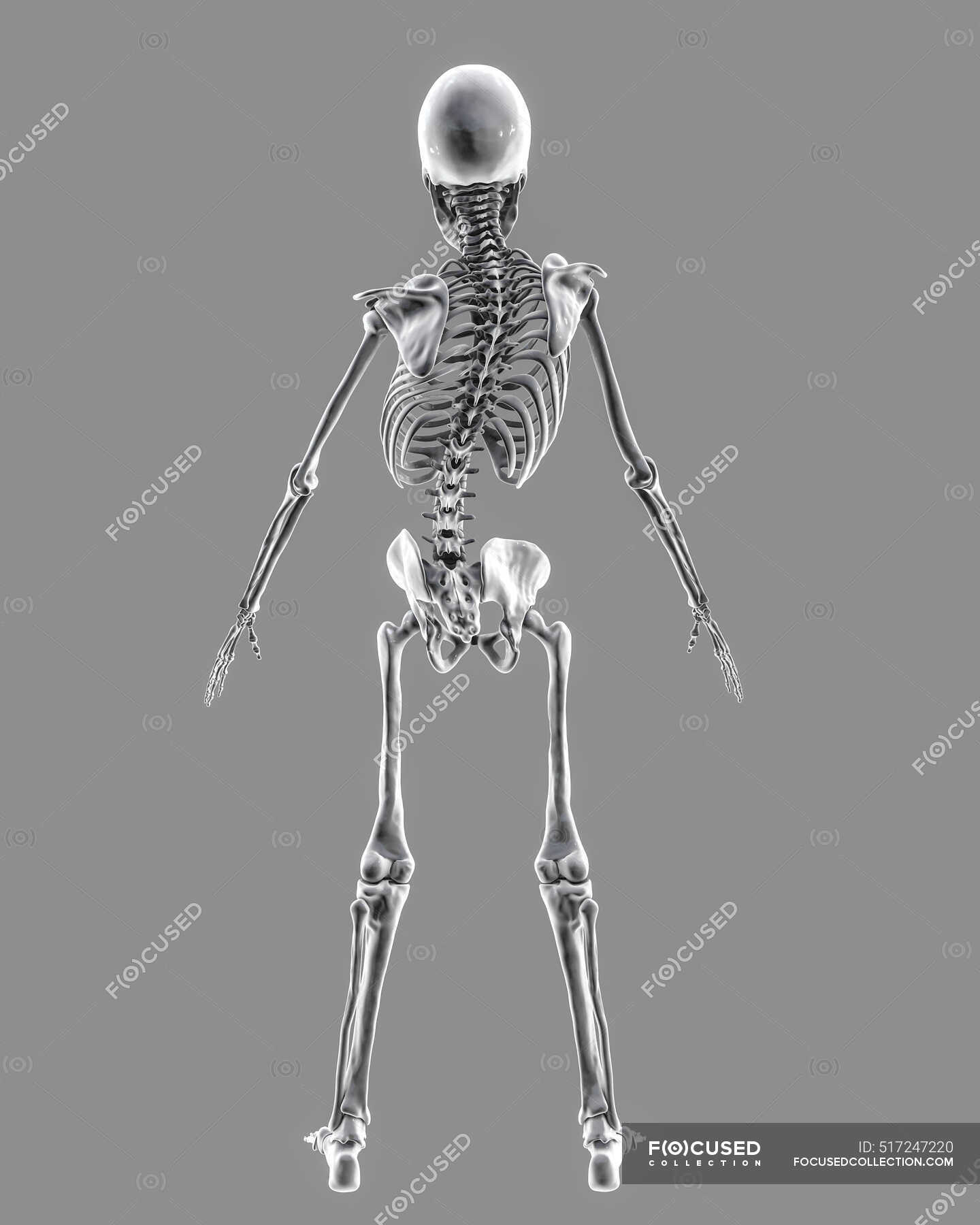 Scoliosis In Children Computer Illustration A Child Skeleton With scoliosis-in-children-computer-illustration-a-child-skeleton-with
