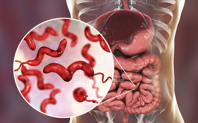Human Intestine And Close Up Of Campylobacter Jejuni Bacteria Causing Campylobacteriosis